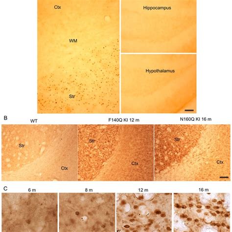 generation of n terminal htt knock in mice a structure of targeting