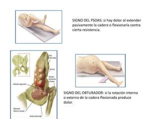 Apendicitis Aguda Pediatriacaso Clinico Y Pptx