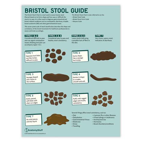 Bristol Stool Chart Poster Of Bristol Stool Chart Antomystuff