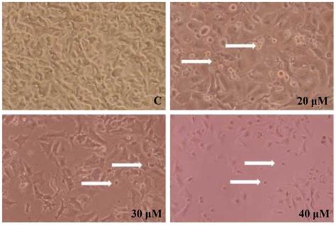 Casticin Induces DNA Damage And Inhibits DNA Repair Associated Protein Expression In B F