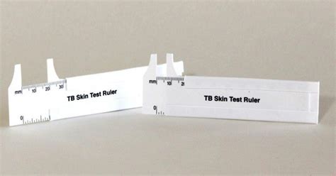 Printable Mantoux Tuberculin Skin Testing Rulers Natu
