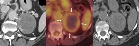 Single Phase Contrast Enhanced CT Images At The Time Of Presentation Download Scientific