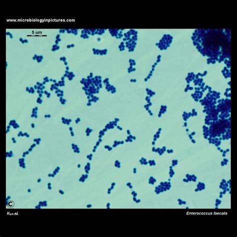 Enterococcus Faecalis Micrograph Gram Stain Enterococci Large Image