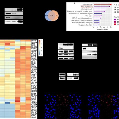 Rbm10 Promotes Dna Replication Fork Progression And Replication Stress Download Scientific