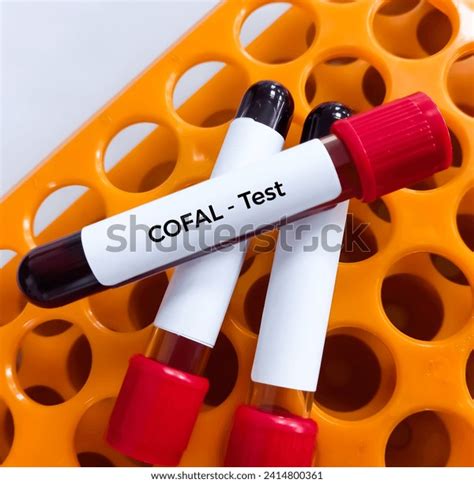 4 Complement Fixation Royalty Free Photos And Stock Images Shutterstock