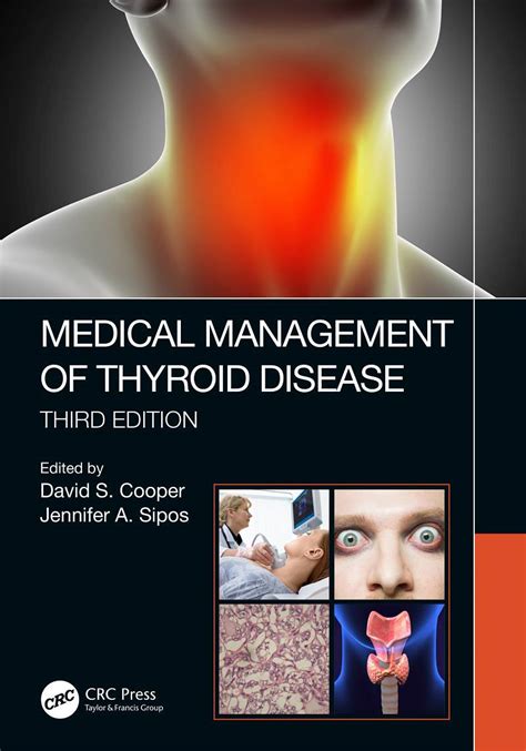 Medical Management Of Thyroid Disease 3rd Edition Capraido Bookstore