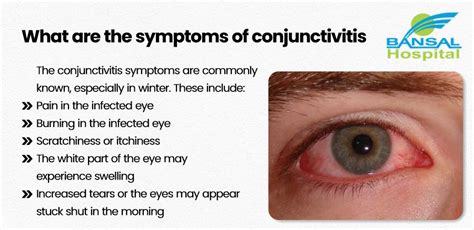 Conjunctivitis