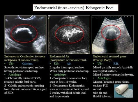 Pin By Luisvaldivieso On GOB Fetal Medical Ultrasound Ultrasound Ultrasound Sonography