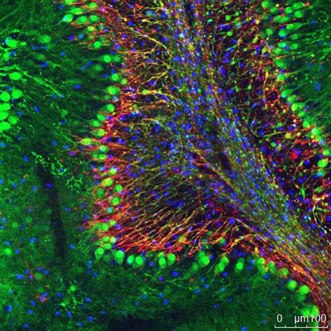 Calbindin Customer Data