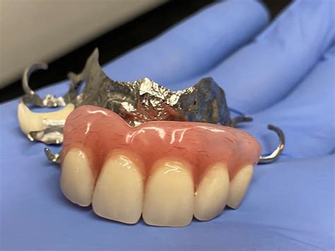 Frameprothese Of Plaatprothese Denteam Clinics