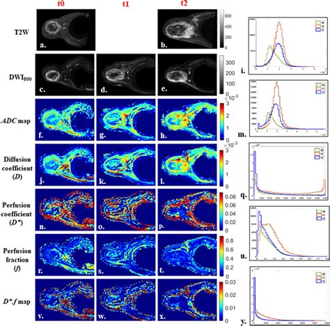 14 Years Old Male Patient From Good Response Group With Localized Download Scientific Diagram