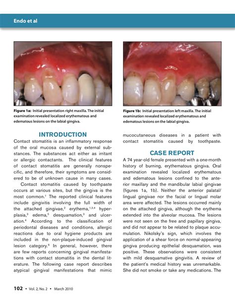 The Art Of Block Grafting Jiacd Page 105 Flip Pdf Online Pubhtml5