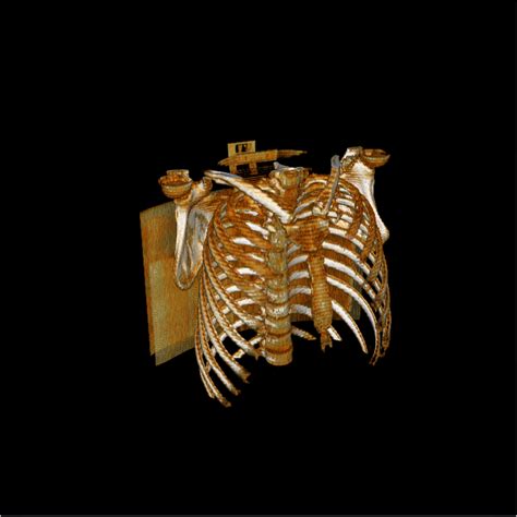 免费在线dicom查看器：高性能医学成像解决方案 3dpea