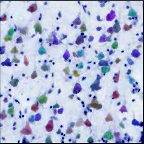 Automatic Cellpose 2 2 Segmentation Of Neurons In Human Neocortex Page 2 Of 5 Brain Imaging