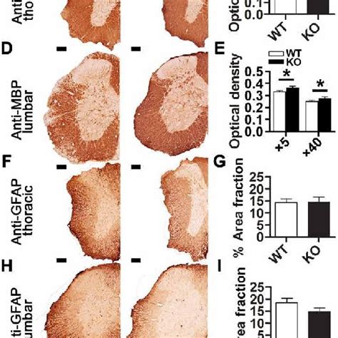 The Glua4 Ampar Subunit Is Reduced In Adult Spinal Cord Download