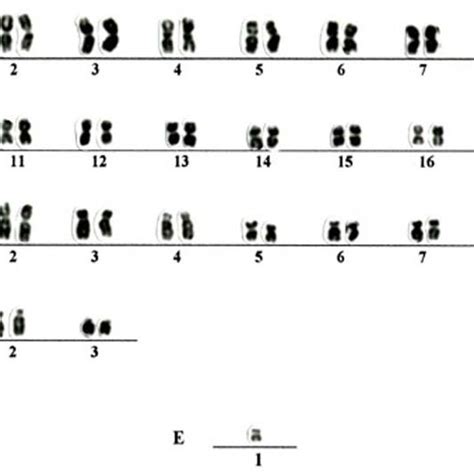 Karyotypes Of The Lineages 2n64 And 2n65 Lymphocytes Culture From