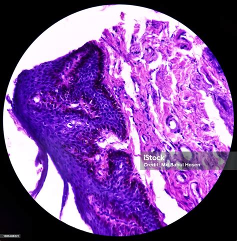 전립선 조직학 섬유 근육 조직을 보여주는 전립선 조직의 현미경 이미지 방광암에 대한 스톡 사진 및 기타 이미지 방광암 건강 검진 건강관리와 의술 Istock