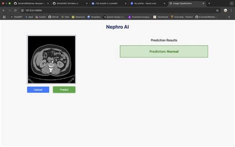 Srinath V On Linkedin Ai Deeplearning Healthcaretech