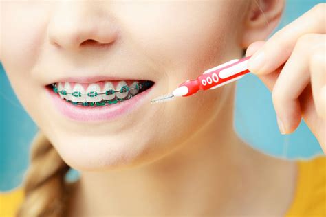 Is Green A Good Color For Braces The Braces Guide