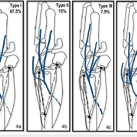 A D Shows The Line Diagram Showing The Varied Branching Pattern Of