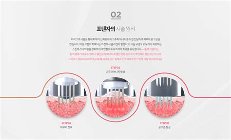 포텐자 에버피부과