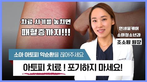 아토피 피부염 평생 간다 연세올케어소아청소년과 Youtube