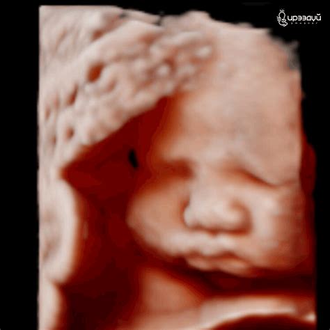 ️ Жирэмсэн ээжүүдээ Ирээдүй эмнэлэг Ireedui Emneleg