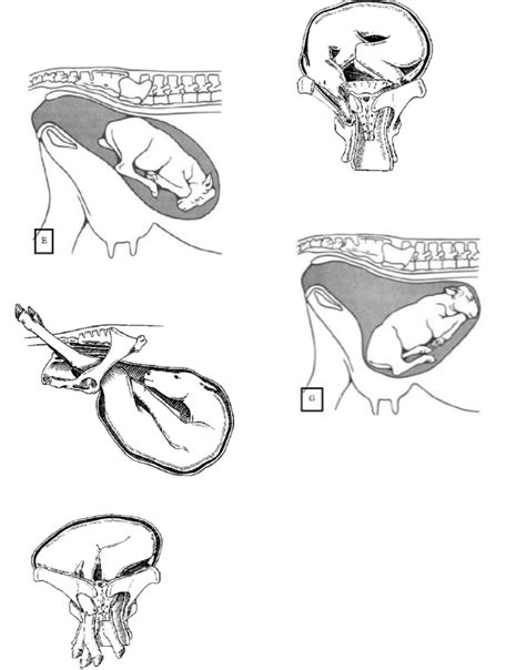 Posição Fetal Melhoramento Genético