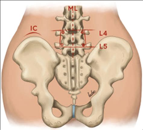 Surgical Neurology International