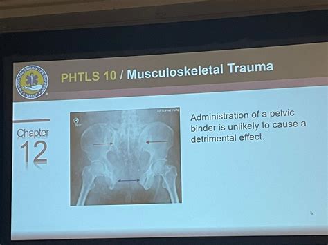 Ems Solutions International By Drramonreyesmd Marca Registrada