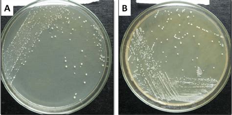 Lactobacillus Colonies