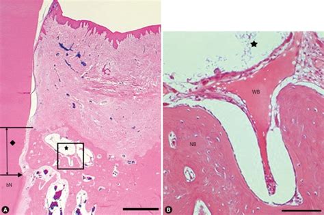 Surgical Sections From The Biphasic Calcium Phosphate Bcp Group A Download Scientific