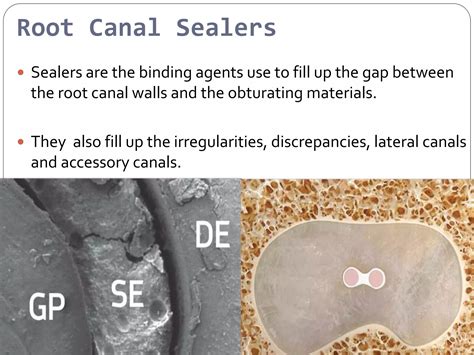 Root Canal Sealers Ppt