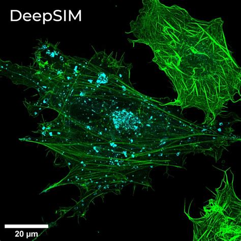 Breaking The Diffraction Limit Discovering Cellular Organelles With Structured Illumination