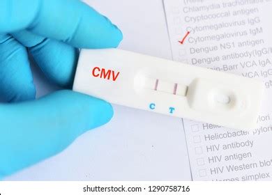 Rsv Positive Test Result By Using Stock Photo Shutterstock