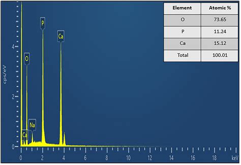 Synthesis And Physicochemical Characterization Of Mesoporous