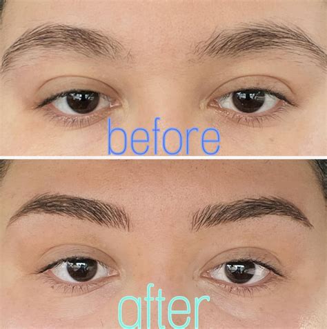 My Before And After The After Is Straight Out From My Appointment I Just Couldnt Believe That