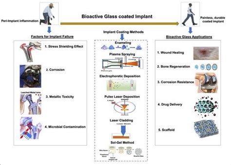 生物活性玻璃在植入物中的应用：综述 Chemistryselect X Mol