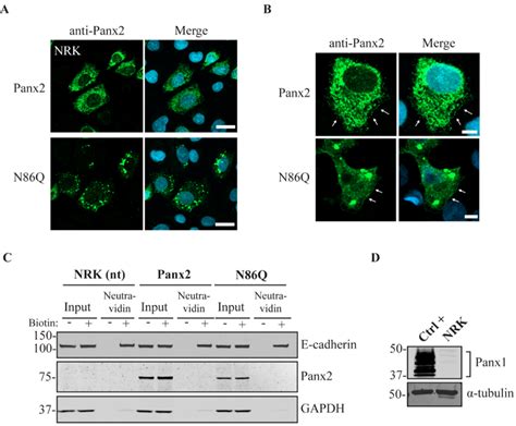 IJMS Free Full Text N Glycosylation Regulates Pannexin 2
