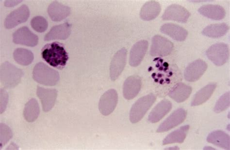 Kostenlose Bild mikroskopische Aufnahme zeigt älter noch wachsen