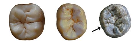 The Wisdom Of Teeth Science Friday
