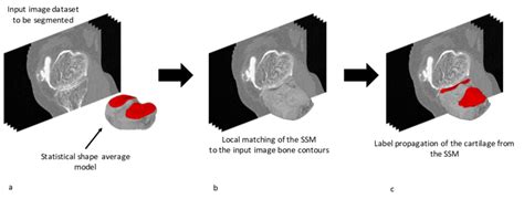 Statistical Shape Model Ssm Segmentation Of The Knee Bone And Download Scientific Diagram