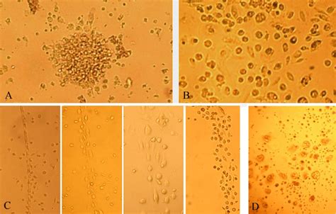 Mononuclear Cells Isolated From Human Umbilical Cord Blood And Cultured