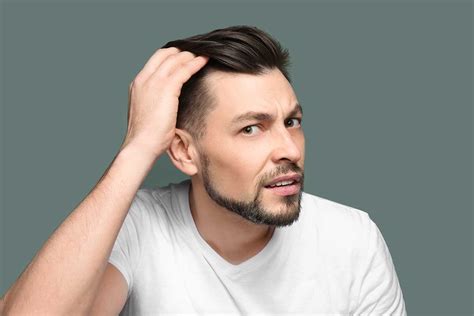 How To Tell If Youre Going Bald The Bald Company