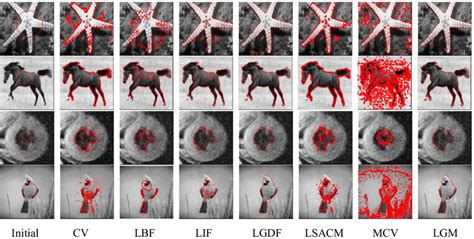 The Segmentation Results Of The Images Contaminated By Speckle Noise Download Scientific