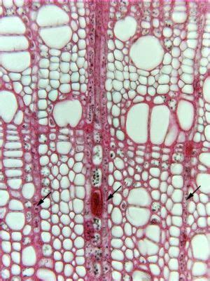 Living Ray Cells Microscopic Photography Microscopic Plant Pattern