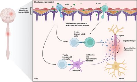 Schematic Representation Of The Sequence Of Events In Multiple