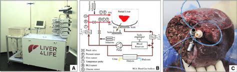 Perfusion Machine For Partial Human Livers A The Wyss Perfusion