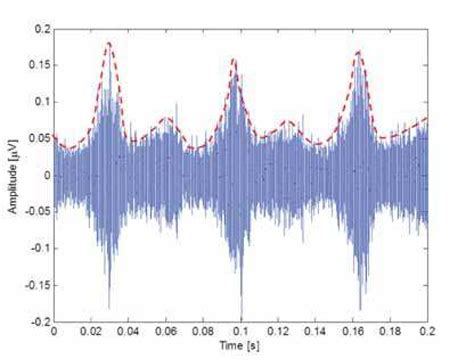 Figure 2 From Machinery Faults Detection Using Acoustic Emission Signal