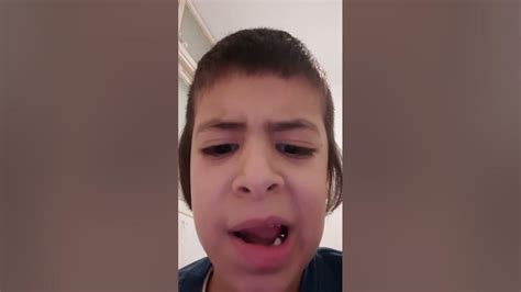 למה יש את הראש של אחוג שלי Youtube